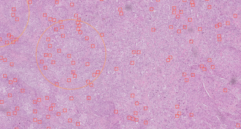 Cleo Skin – AI Solution to detect Skin Cancer