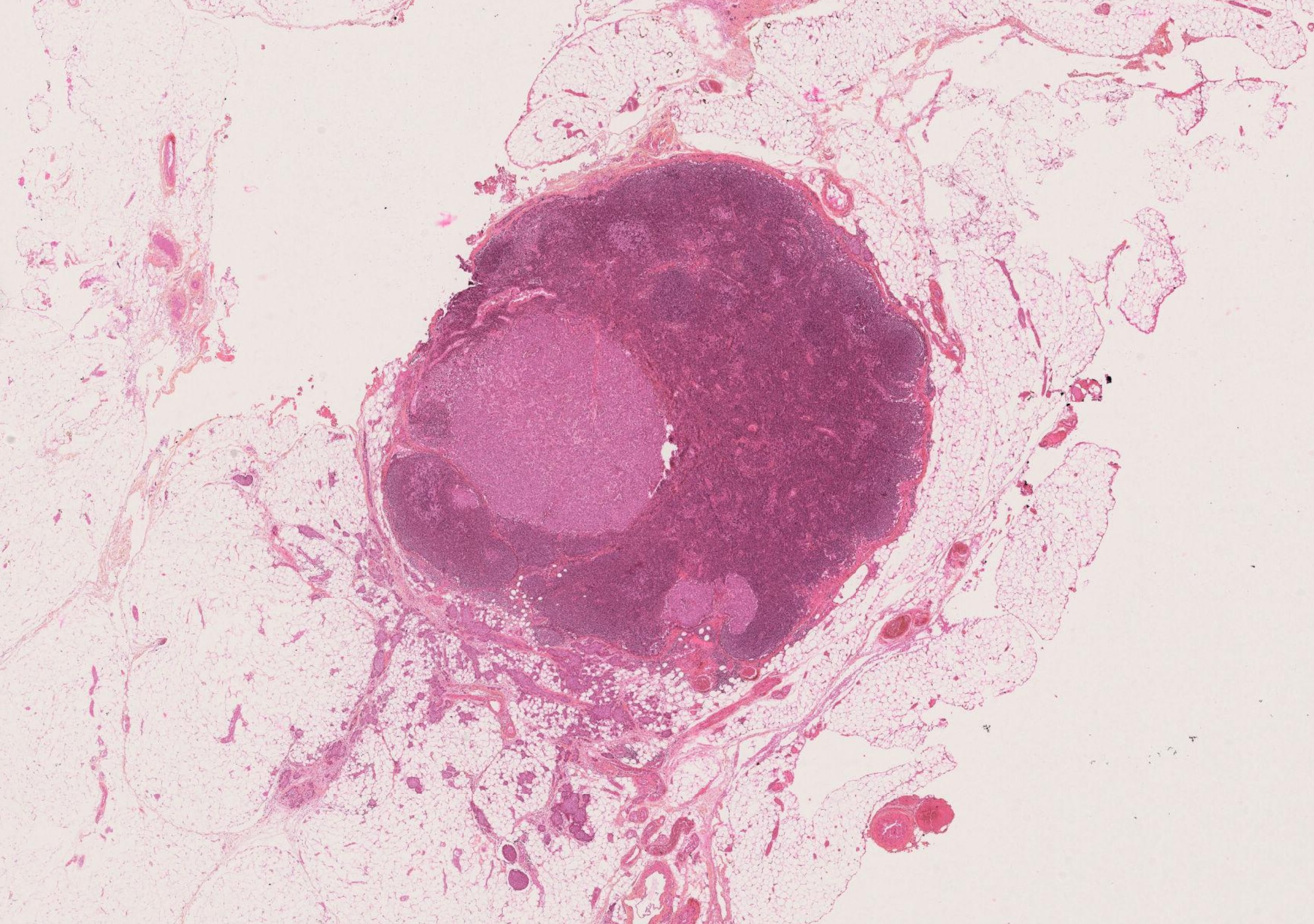 Standardized CycleGAN Training for Unsupervised Stain Adaptation in ... Standardized CycleGAN Training for Unsupervised Stain Adaptation in ...