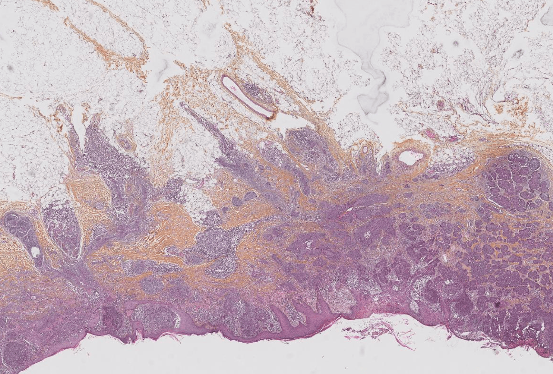 Evaluation of diagnostic performance and clinical utility of Cleo ...